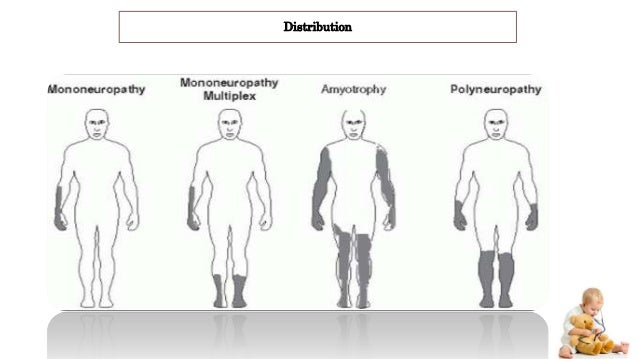 Giant axonal neuropathy