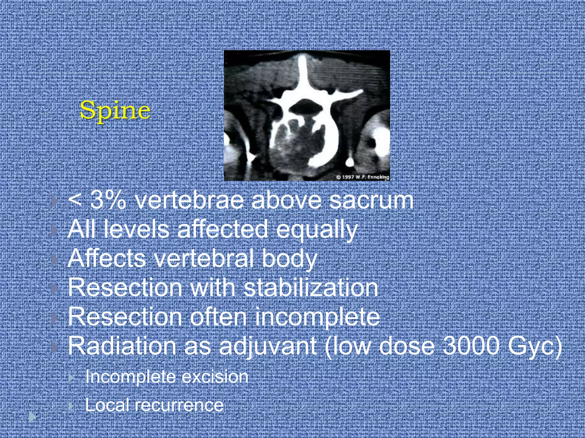"GIANT CELL TUMOR" : CASE PRESENTATION- At Shaheed Suhrawardy Medical ...