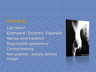 "GIANT CELL TUMOR" : CASE PRESENTATION- At Shaheed Suhrawardy Medical ...