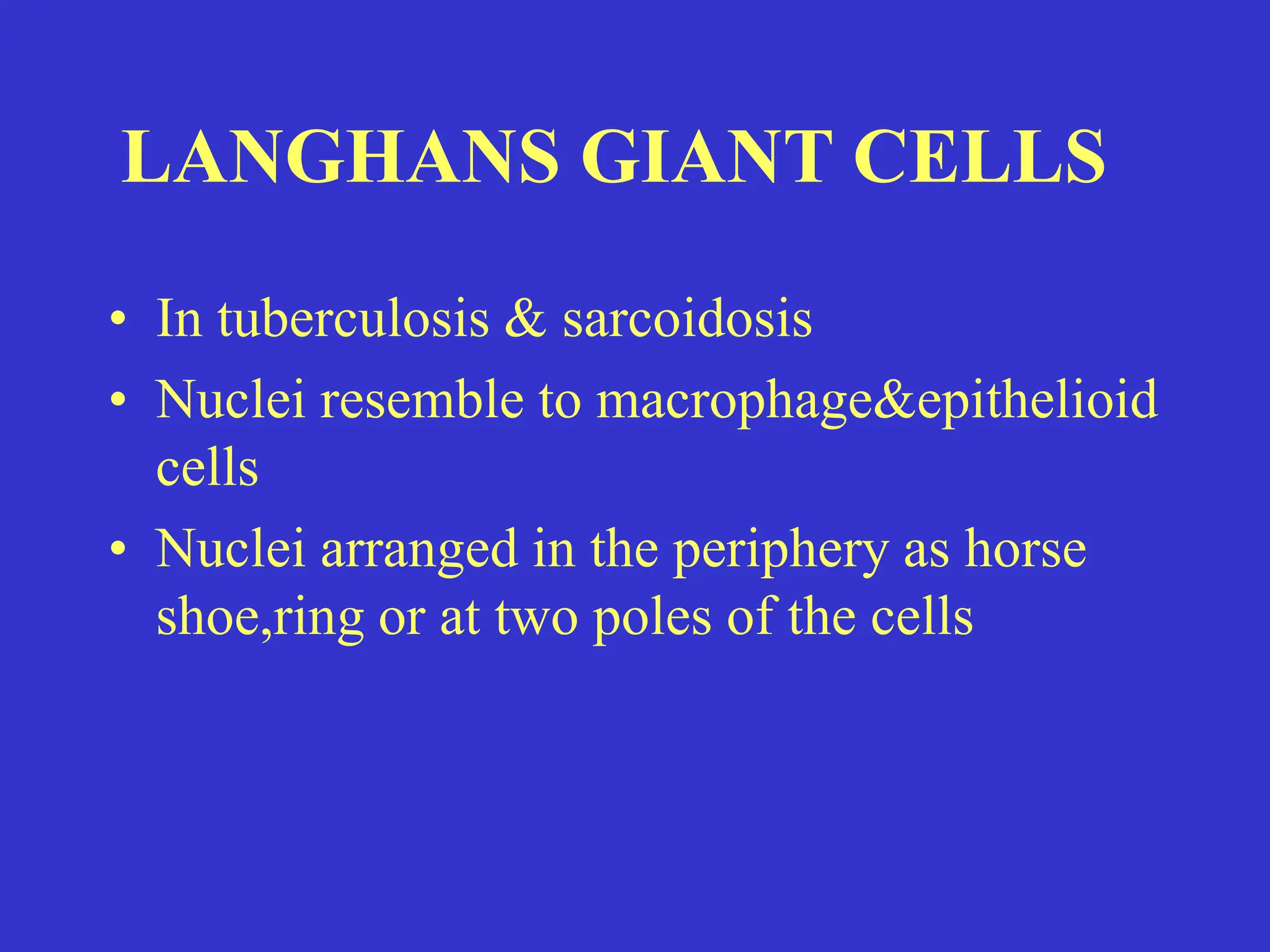 GIANT Cell tumour orthopaedics pathology.ppt