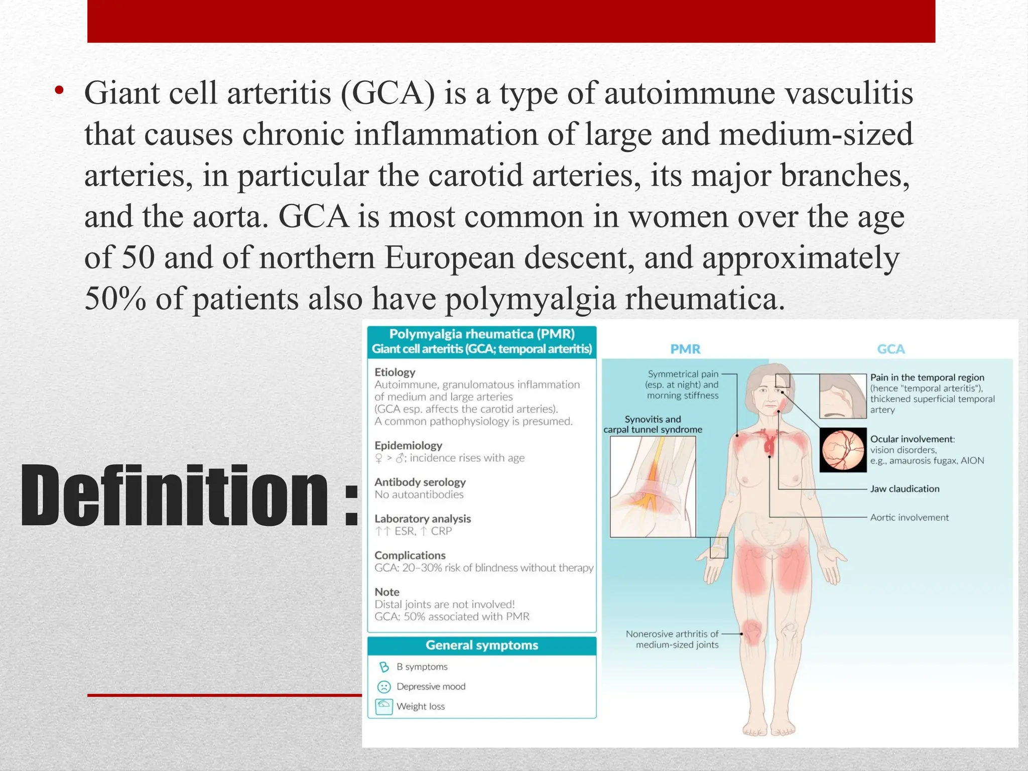 Giant cell arteritis disease presentation.pptx