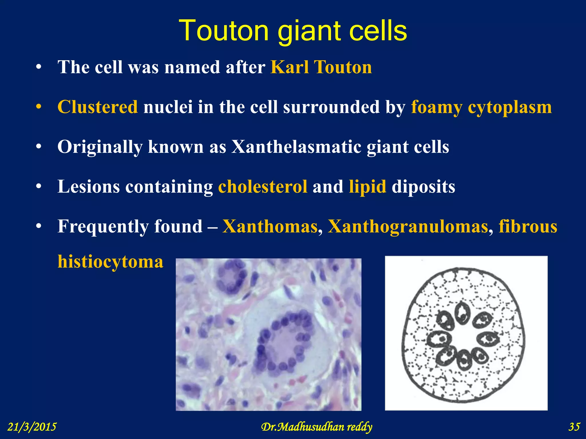 Giant cell formation and function ppt | PPTX