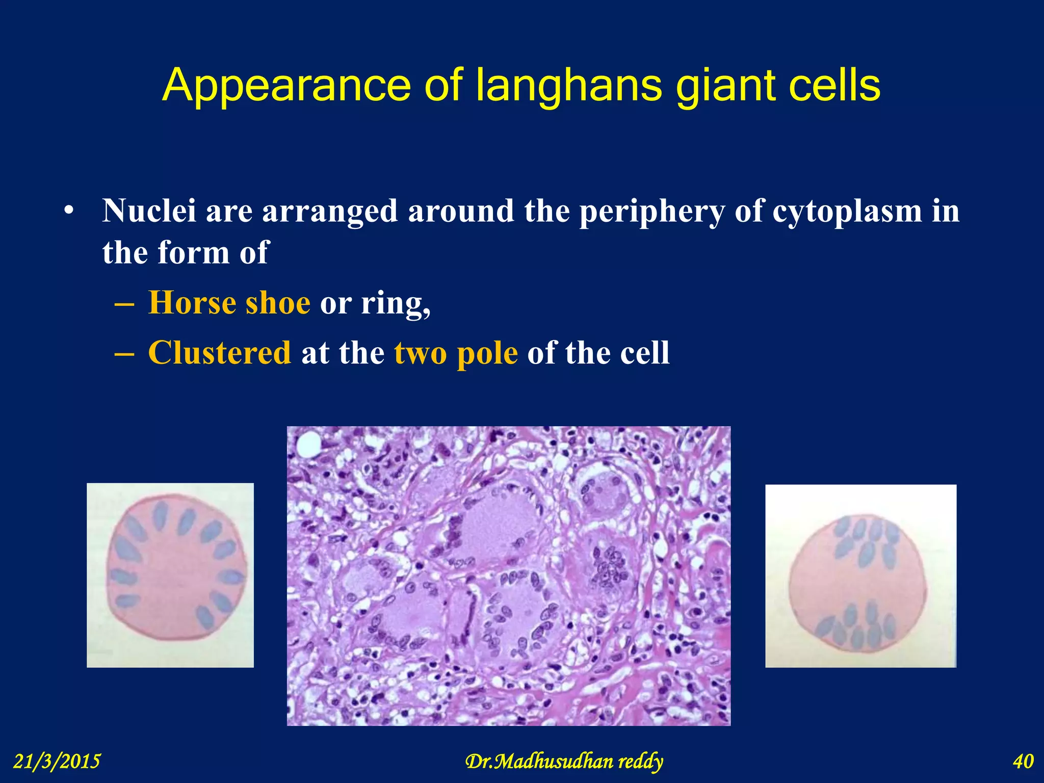 Giant cell formation and function ppt | PPTX
