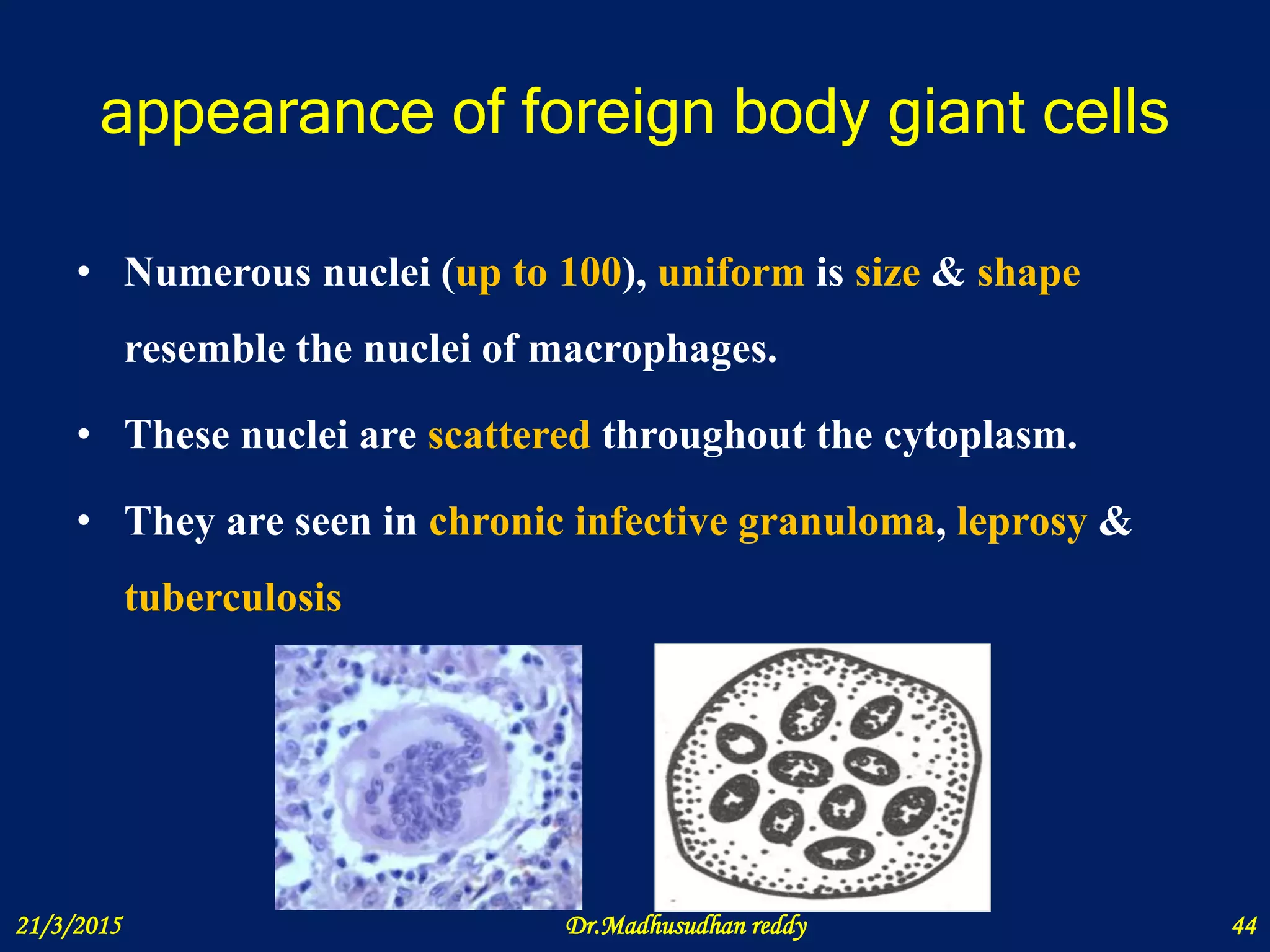 Giant cell formation and function ppt | PPTX