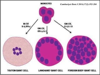 Giant cell formation and function ppt | PPTX