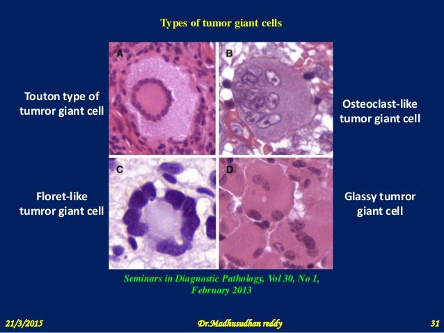 Giant cell formation and function ppt
