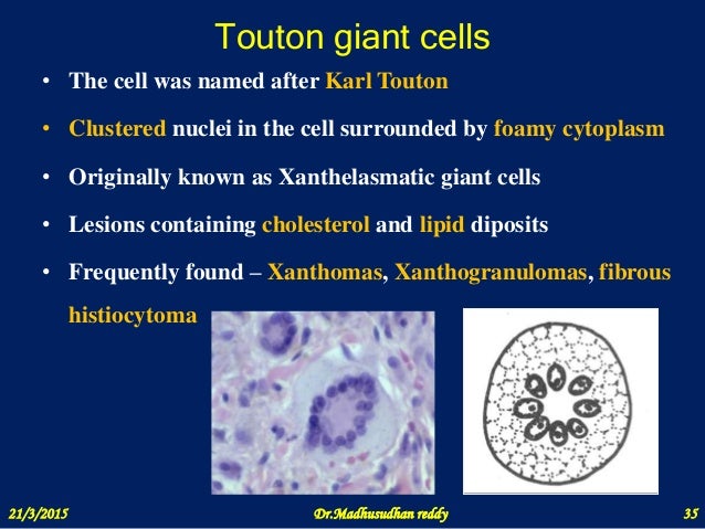 Giant cell formation and function ppt