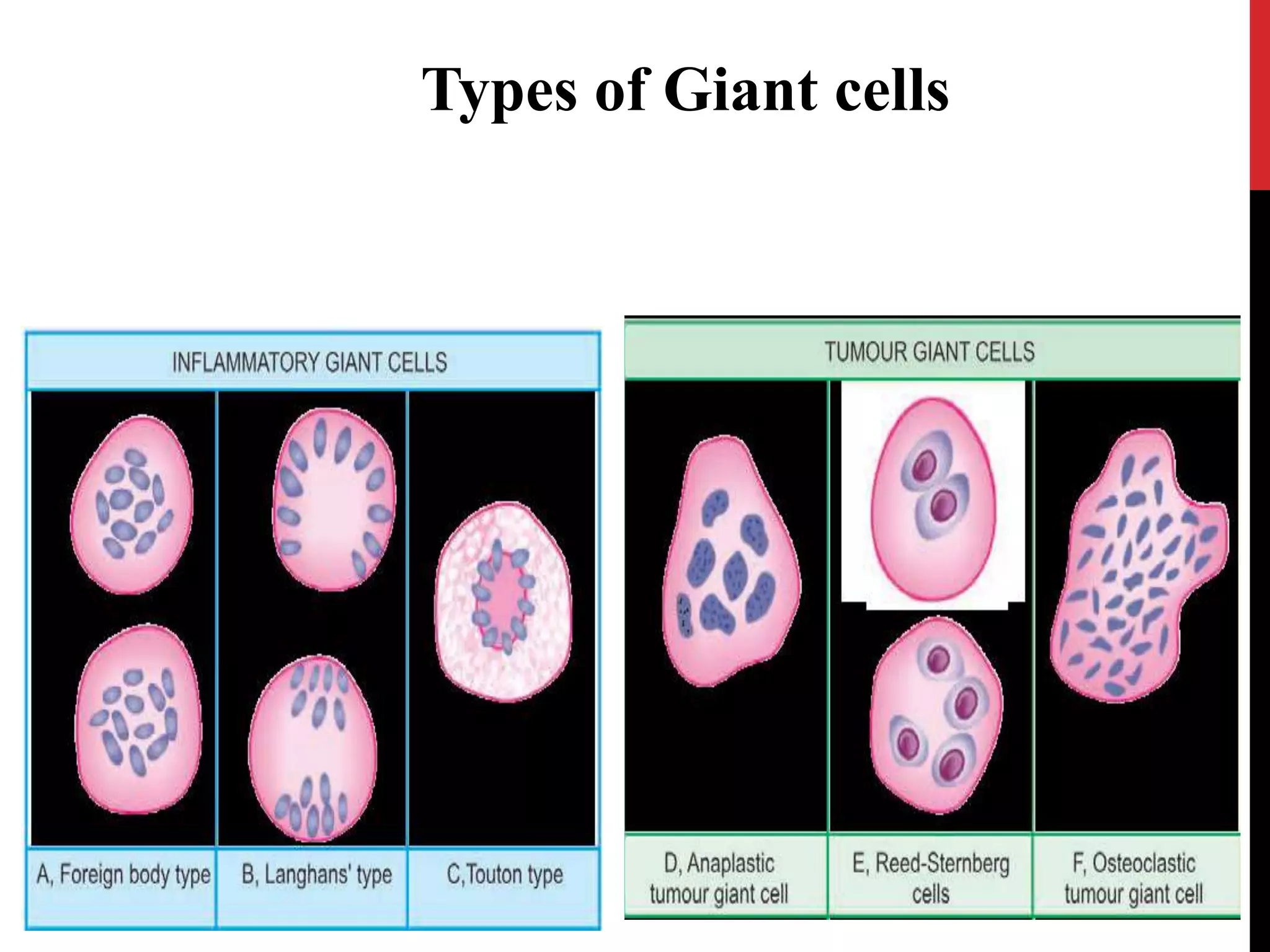 Giant cell lesion.pptx