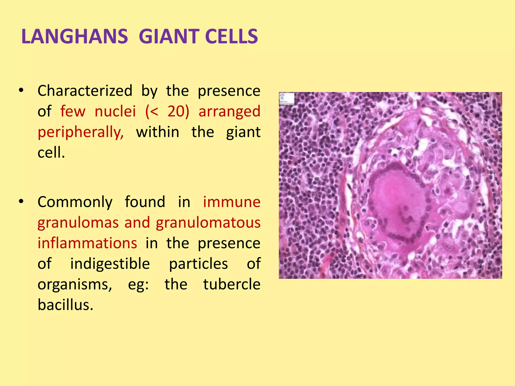 GIANT CELL LESIONS.pptx