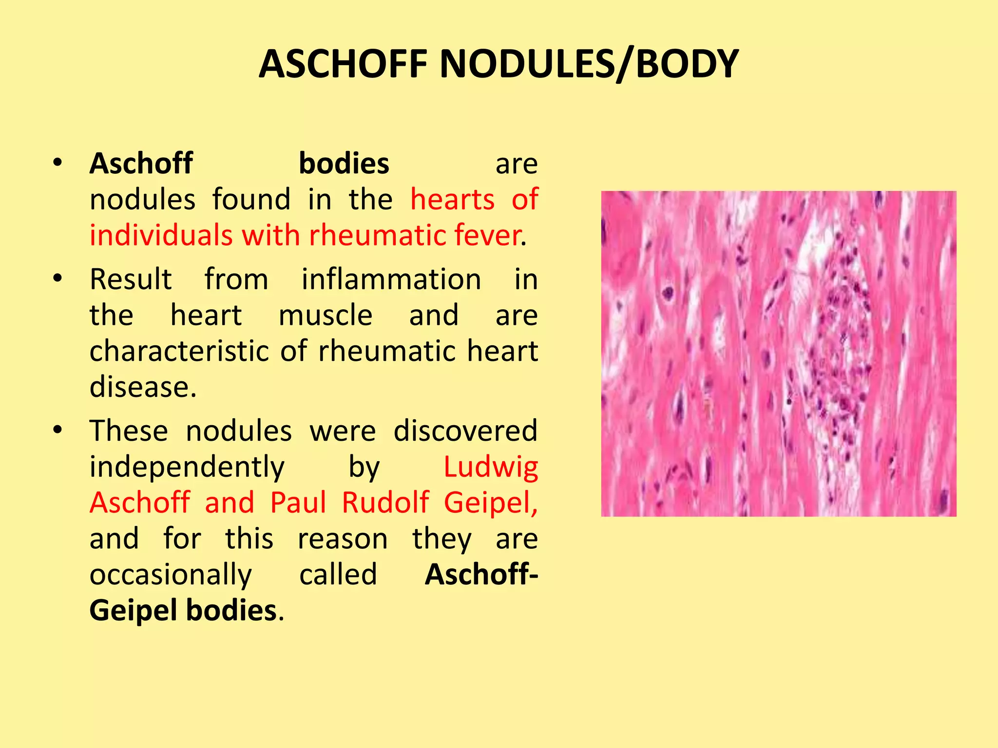 GIANT CELL LESIONS.pptx