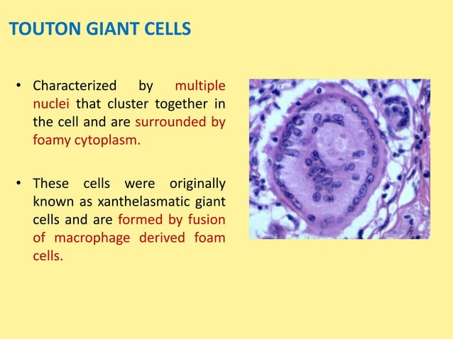 GIANT CELL LESIONS.pptx