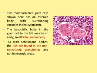 Schaumann And Asteroid Bodies