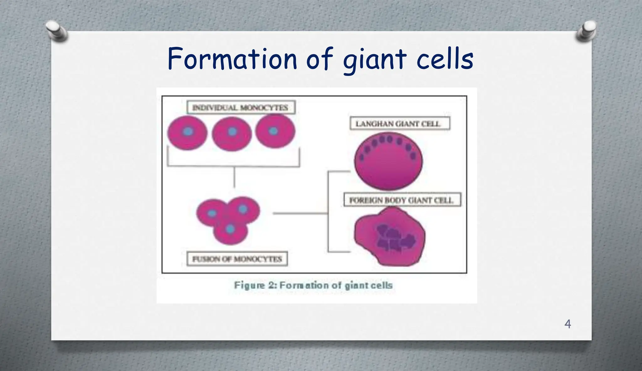 Giant cell lesions in maxillofacial region from cawson essential of ...