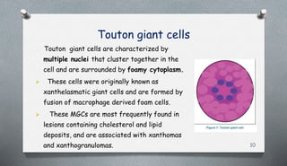 Giant cell lesions in maxillofacial region from cawson essential of ...