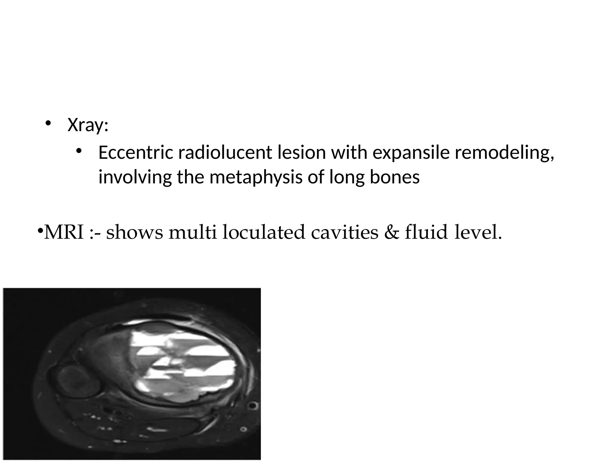giant cell lesions bone.pptx for patholgy pgs | PPTX
