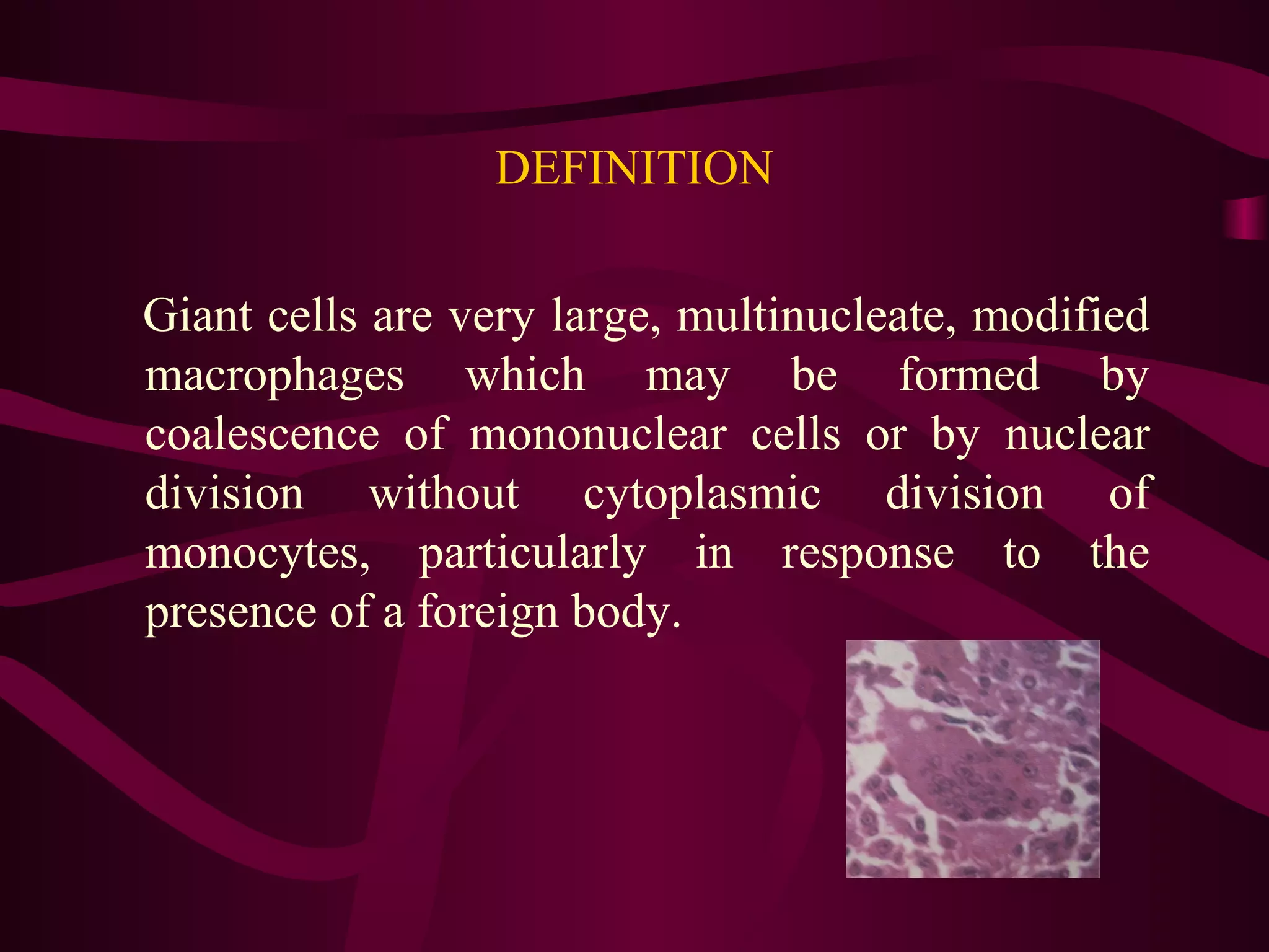 Giant cell lesion’s of jaw | PPT