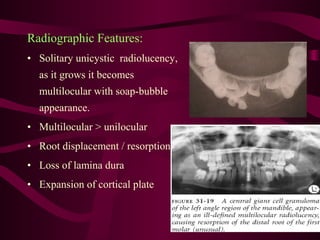 Giant cell lesion’s of jaw | PPT