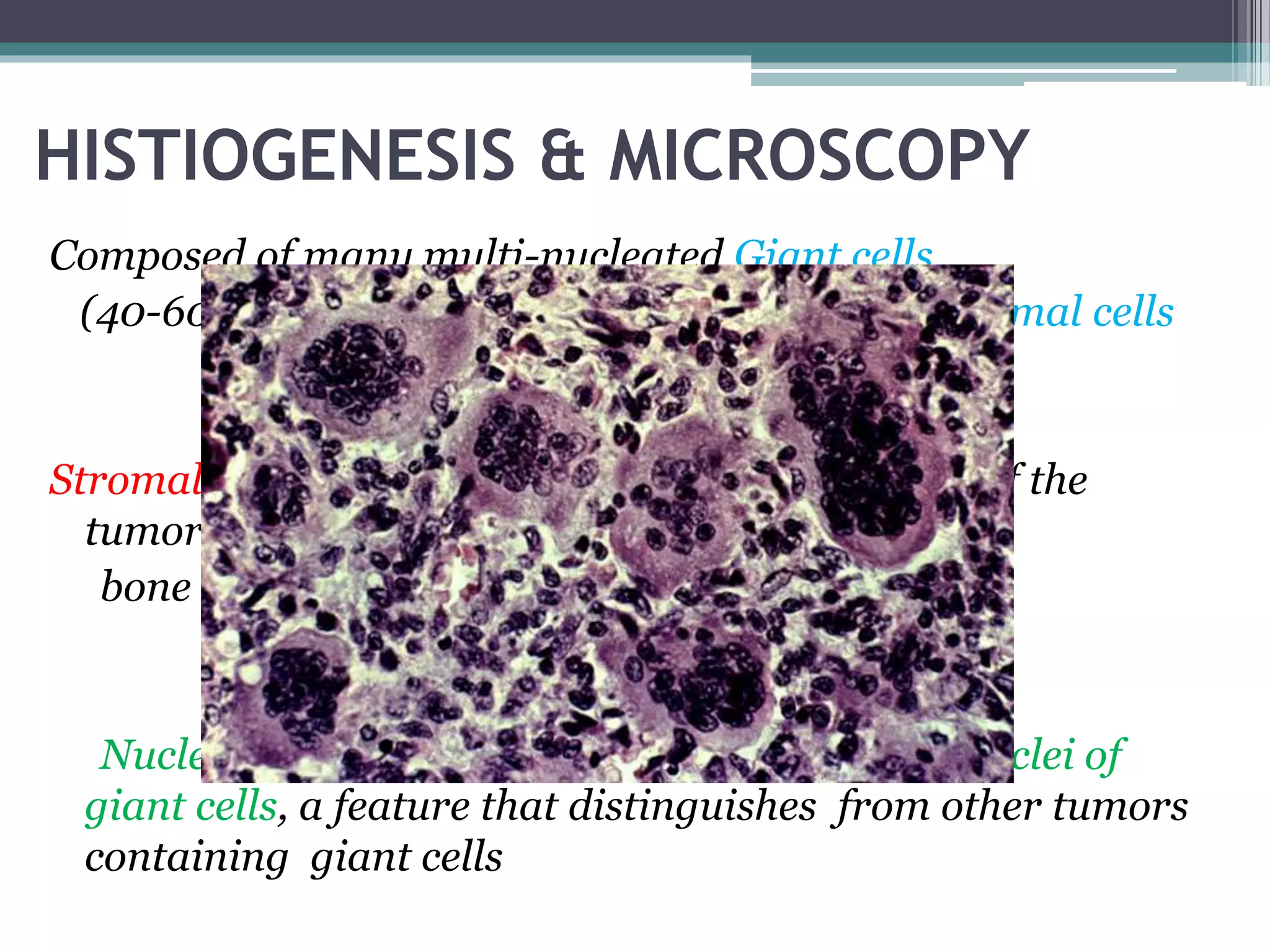 Giant cell tumor | PPTX