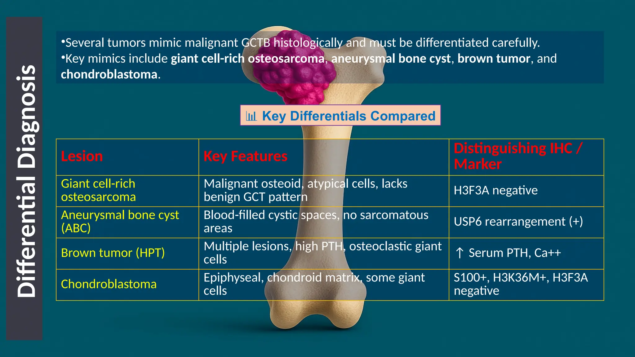 giant cell tumor malignant management.pptx