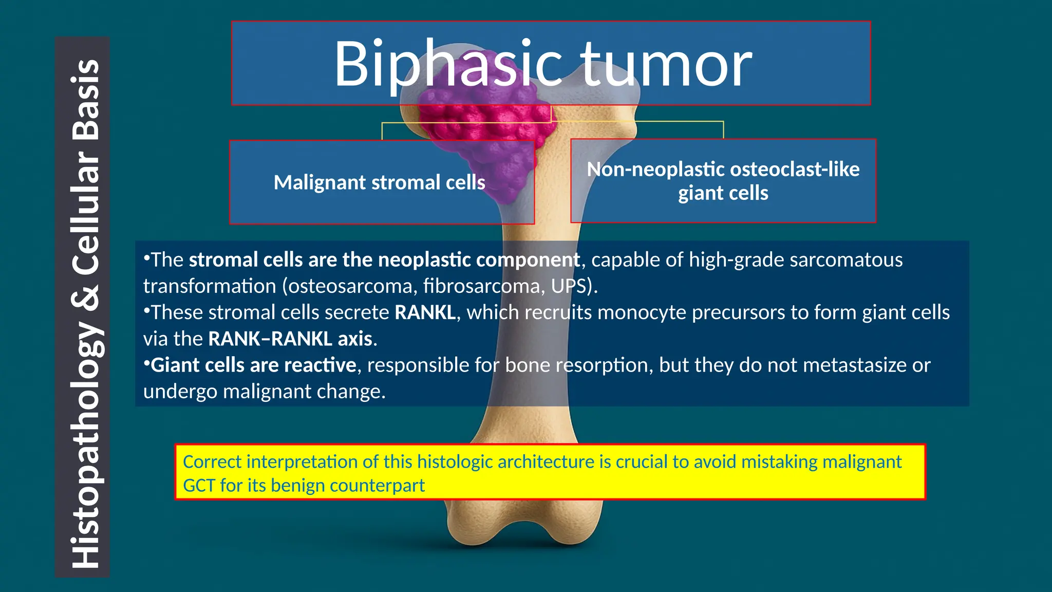 giant cell tumor malignant management.pptx