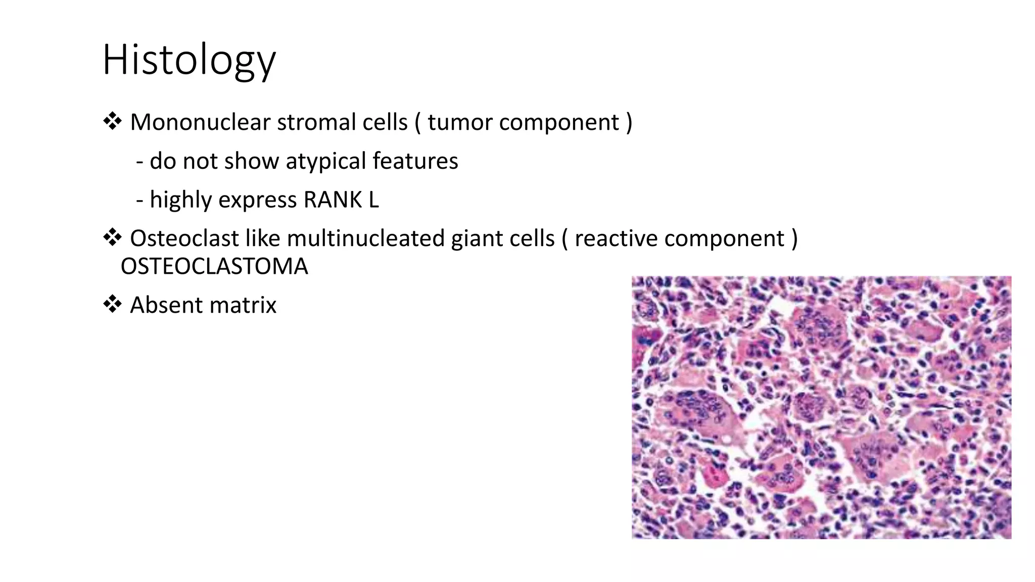 Giant cell tumor of bone.pptx