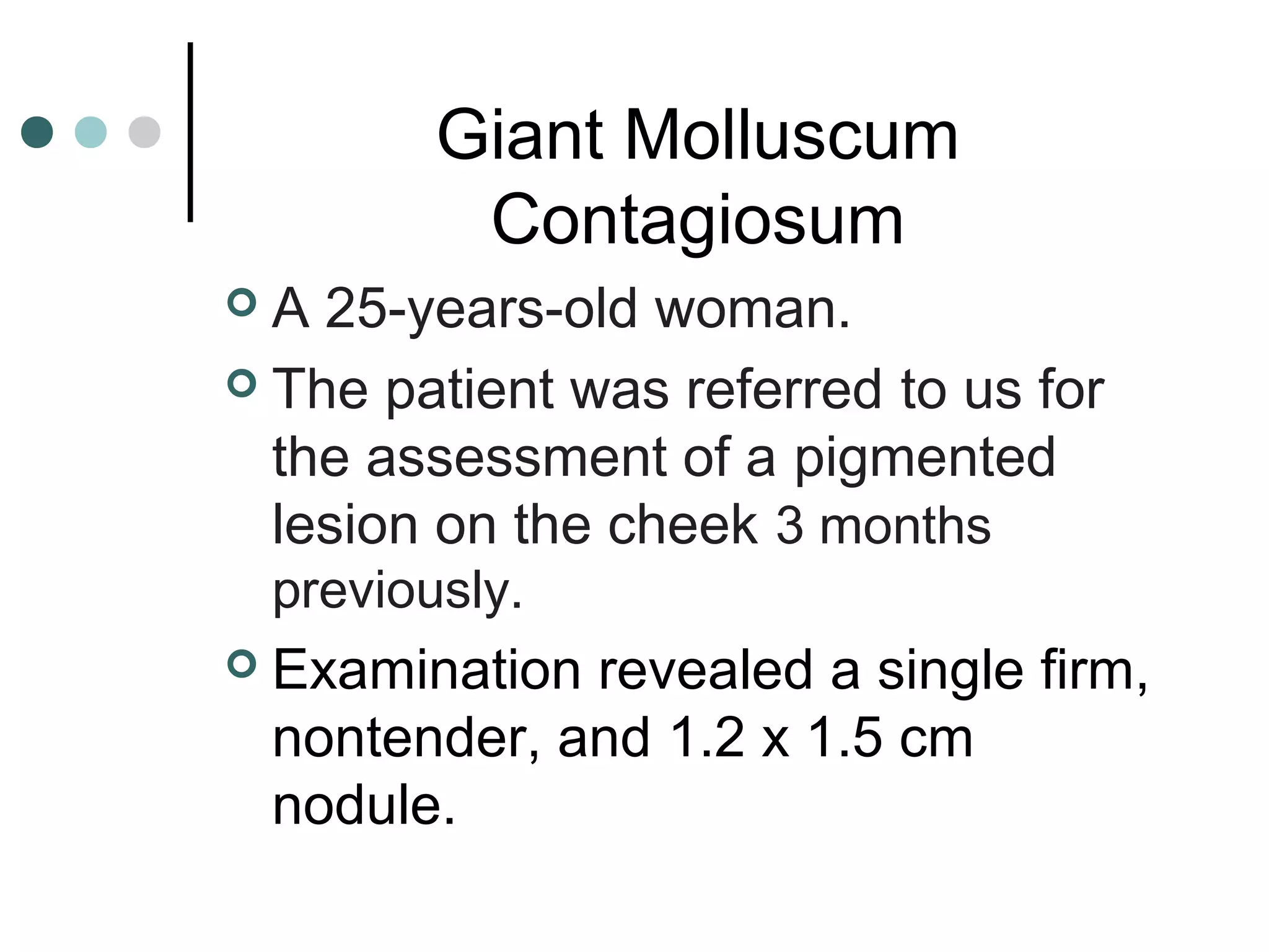 Giant molluscum contagiosum | PPT
