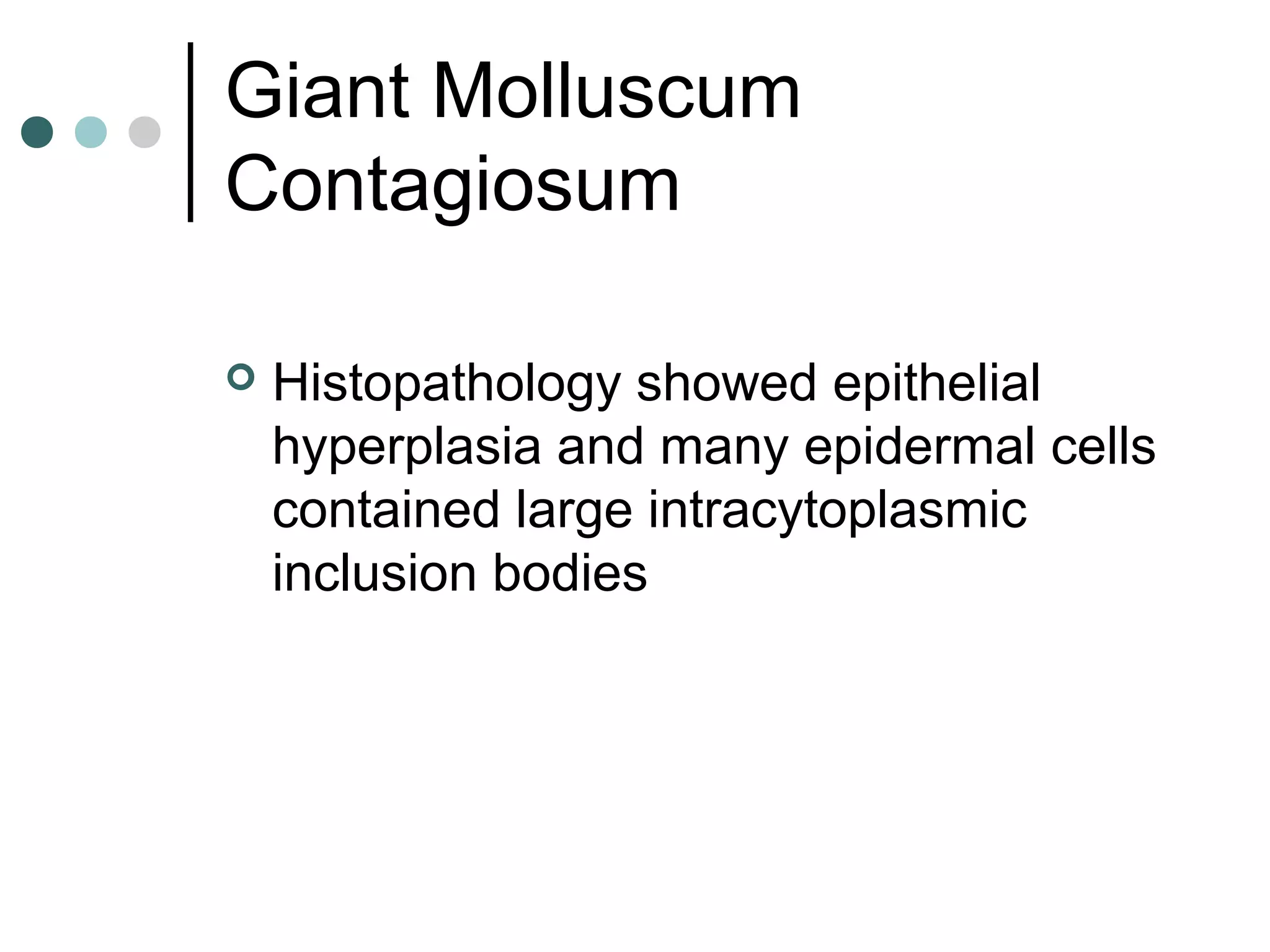 Giant molluscum contagiosum | PPT