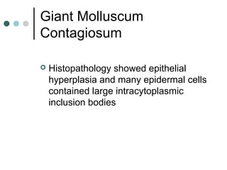 Giant molluscum contagiosum | PPT