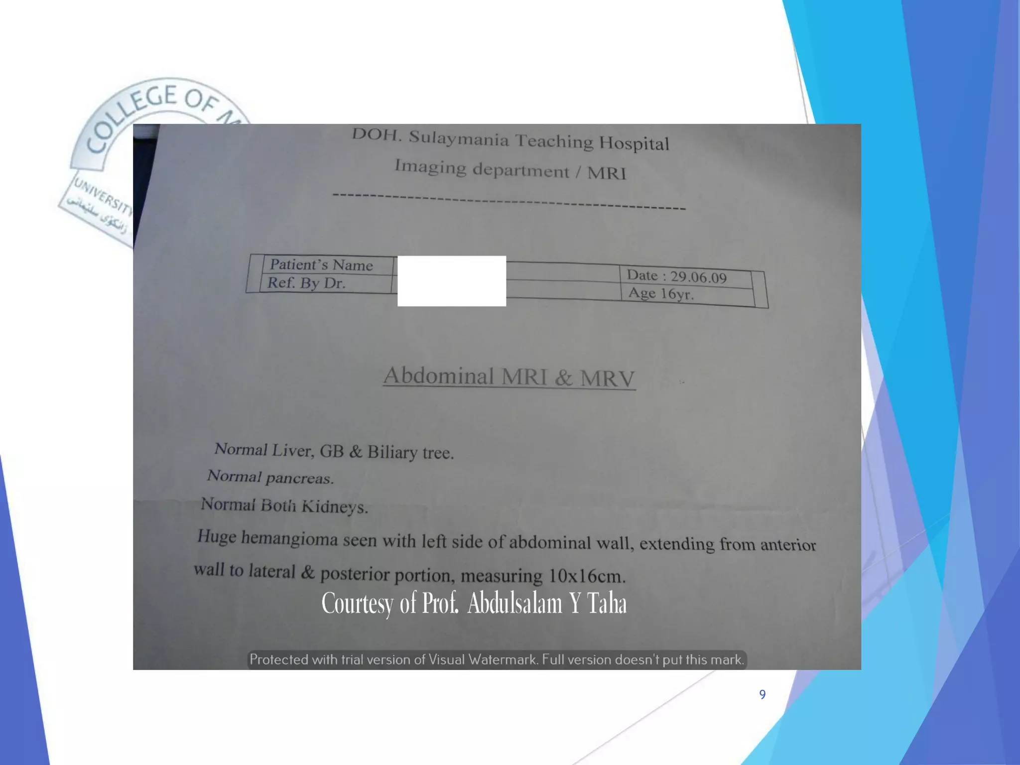 Giant Recurrent Flank Haemangioma.pdf