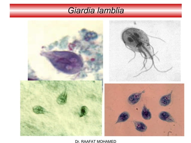 protozoa presentation giardia lamblia.ppt