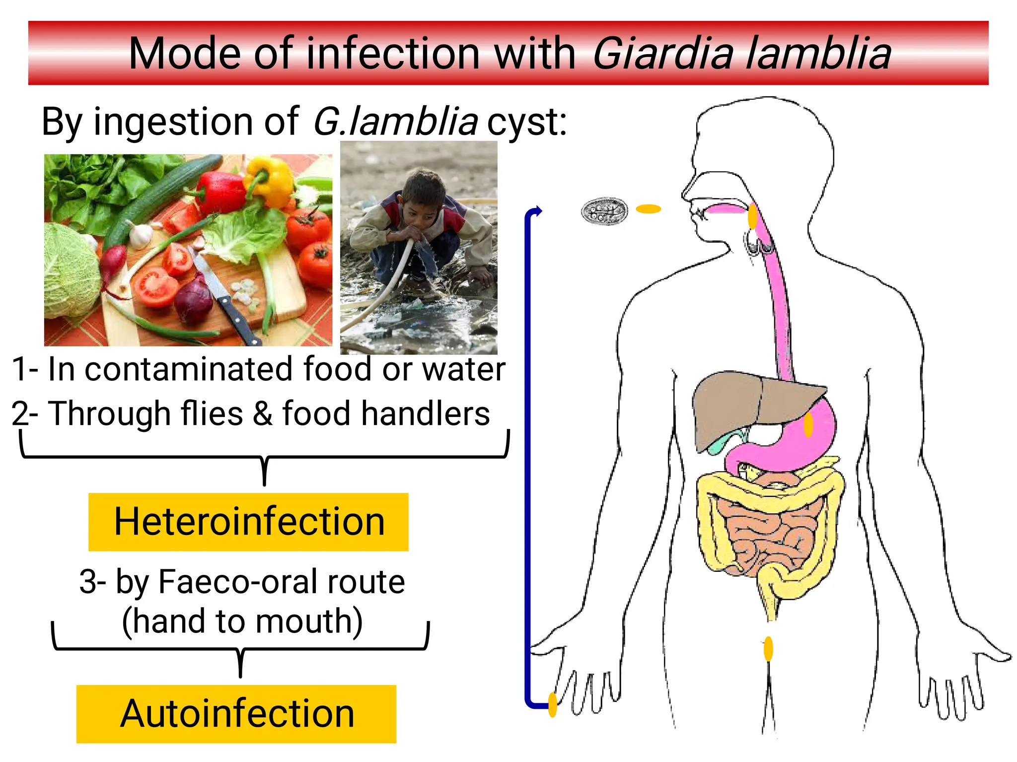 Giardia Lamblia Parasitology Medical Pdf