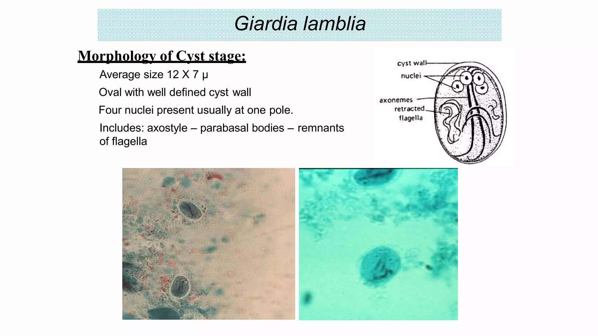 giardialamblia ppt.pptx