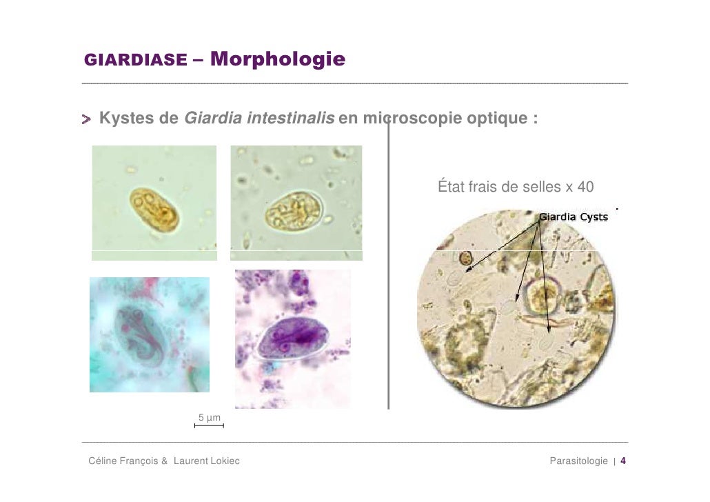 Quels Sont Les Symptmes De La Giardiase 4 Tapes