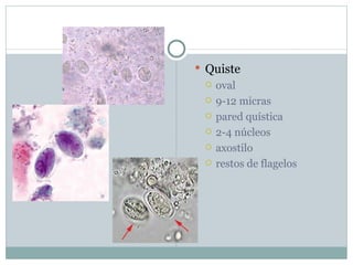 Giardiasis | PPT