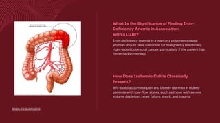 LOWER GI BLEEDING.pptx