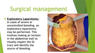 GI BLEED.pptx- introduction, definition, types, causes, signs and symptoms, diagnostic ...