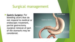 GI BLEED.pptx- introduction, definition, types, causes, signs and ...