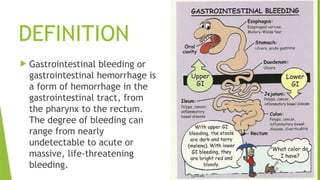 GI BLEED.pptx- introduction, definition, types, causes, signs and ...