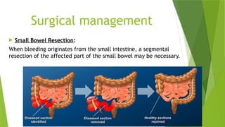 GI BLEED.pptx- introduction, definition, types, causes, signs and symptoms, diagnostic ...