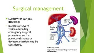 GI BLEED.pptx- introduction, definition, types, causes, signs and ...