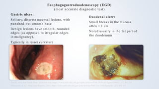Gastrointestinal bleeding( type,cause,management) .pptx | Digestive ...