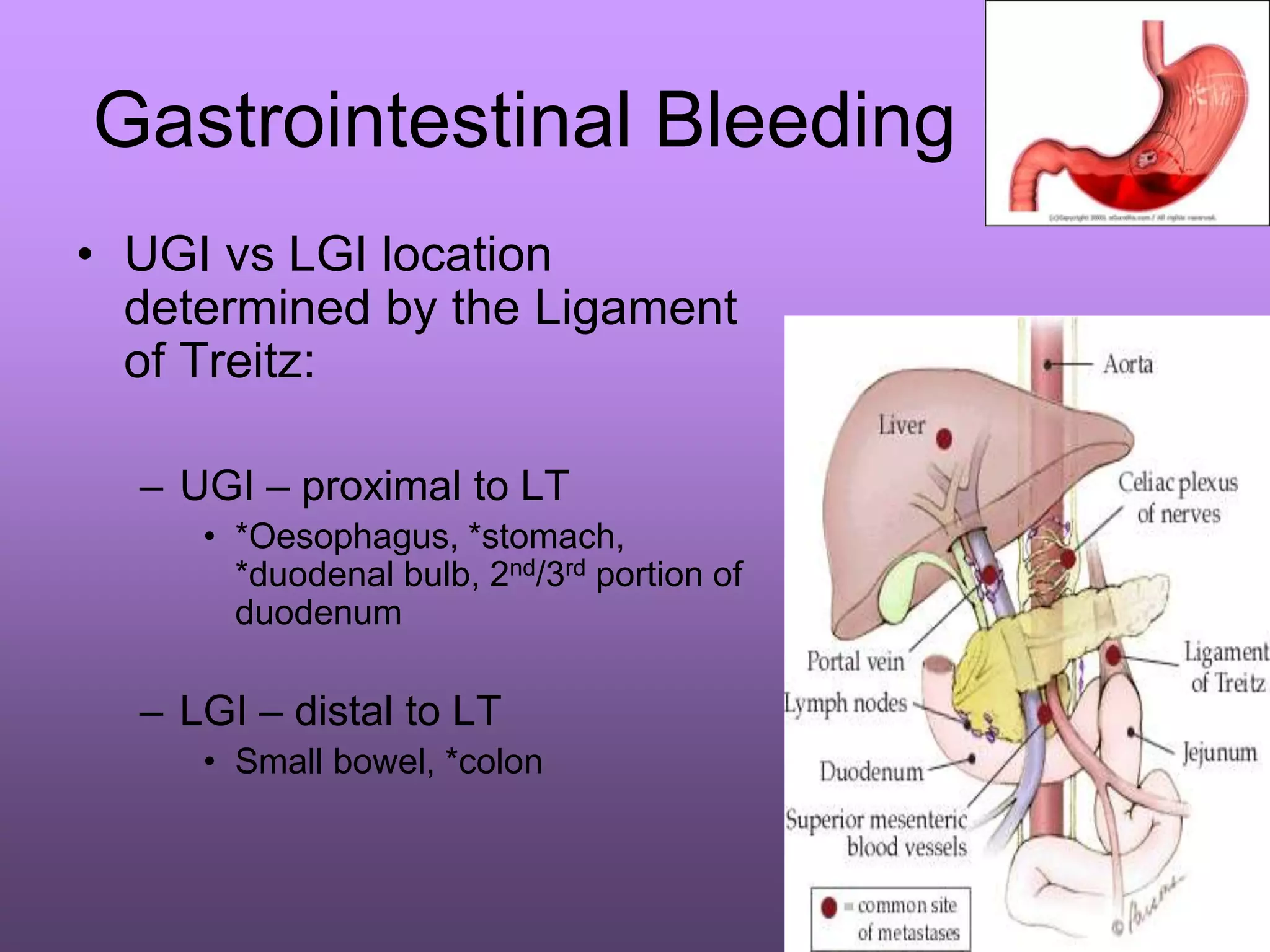 GI BLEED FOR NURSES.ppt