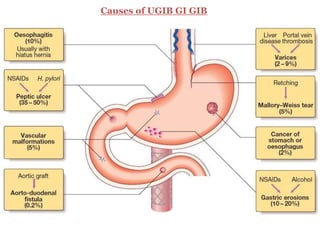 Upper GI bleeding | PPTX
