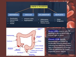 GI bleeding Introduction & References.pptx