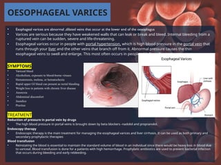 GI bleeding Introduction & References.pptx