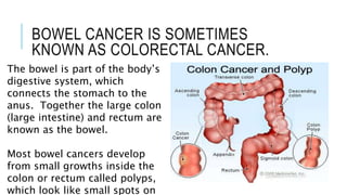 Gastro Intestinal Cancer | PPTX