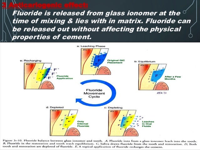 Glass ionomer cement