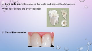 GIC & its Advances Also provides its advantages, disadvantages ...