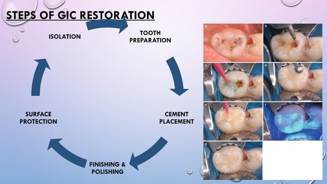 GIC & its Advances Also provides its advantages, disadvantages ...