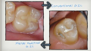 modification done in gic gic gimc gic gic | PPT